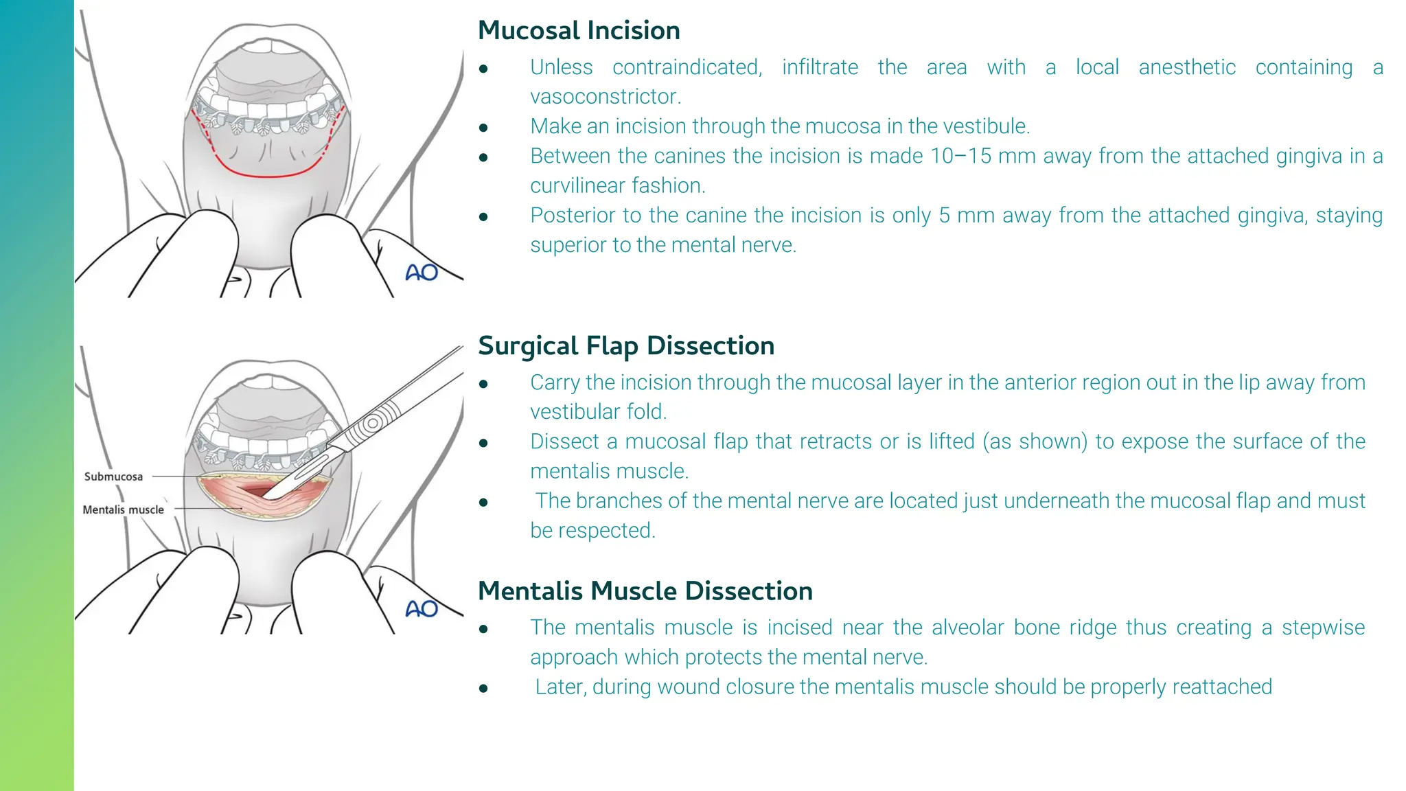 Fractures of The Body of The Mandible In Maxillofacial Surgery | PDF