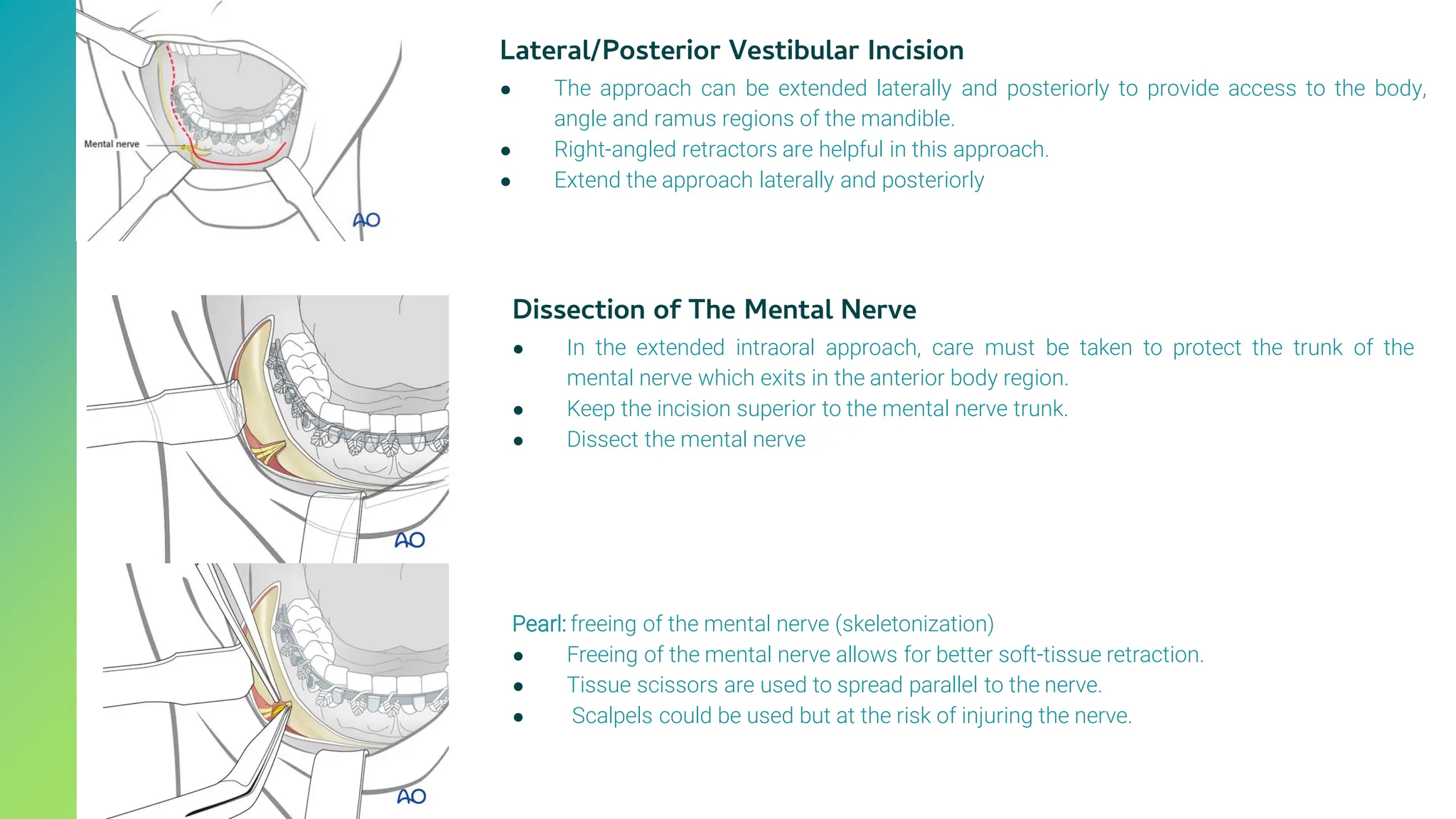 Fractures of The Body of The Mandible In Maxillofacial Surgery | PDF