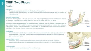 Fractures of The Body of The Mandible In Maxillofacial Surgery | PDF