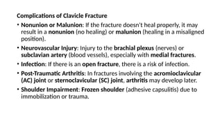 Fracture of Clavicle and Scapulawie.pptx