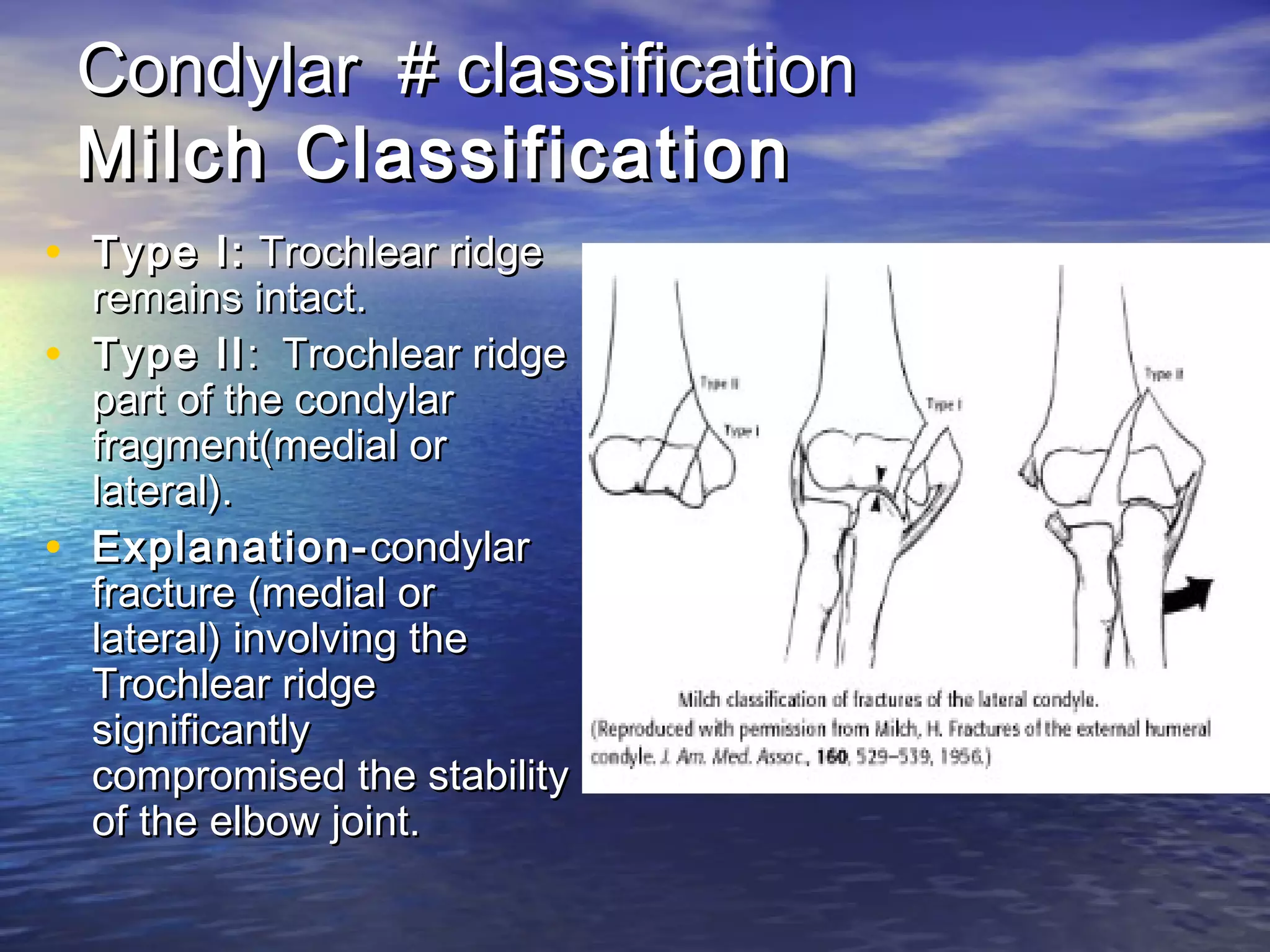Fracture of Distal End Humerus. | PPT