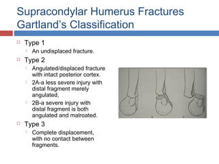 Fracture of Distal End Humerus. | PPT