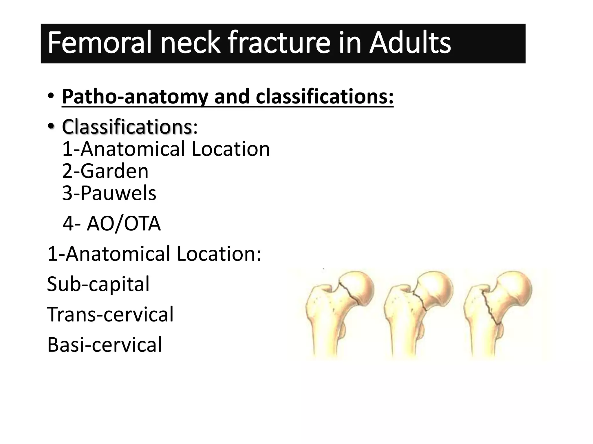 Fracture Of Femoral Neck In Adults.pptx