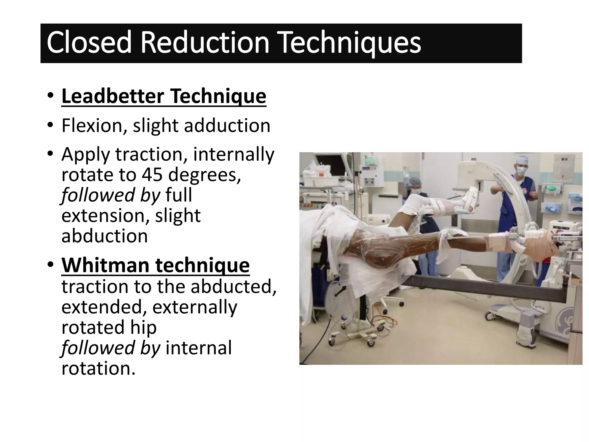 Fracture Of Femoral Neck In Adults.pptx