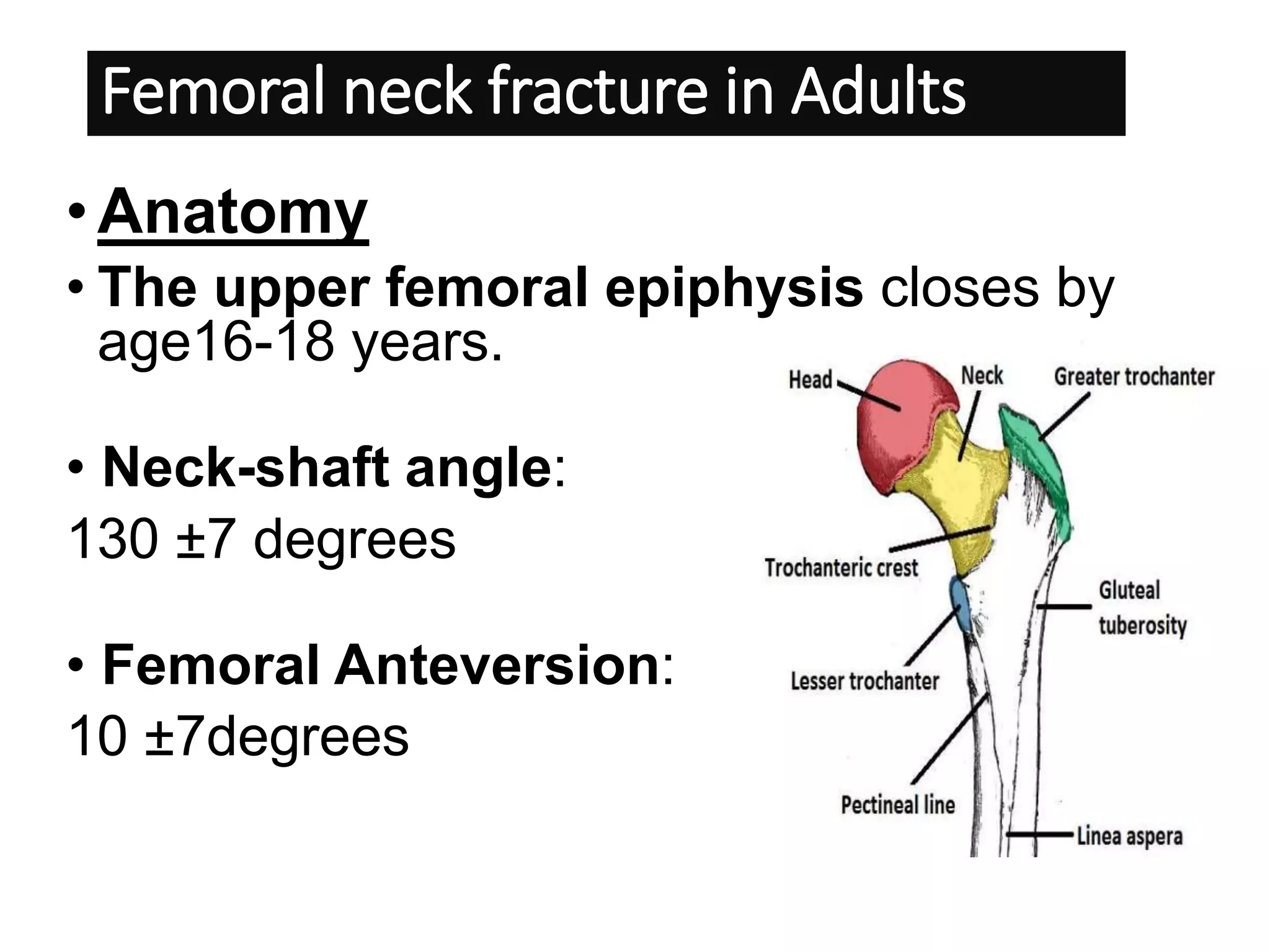 Fracture Of Femoral Neck In Adults.pptx | Death, Injury, or Military ...