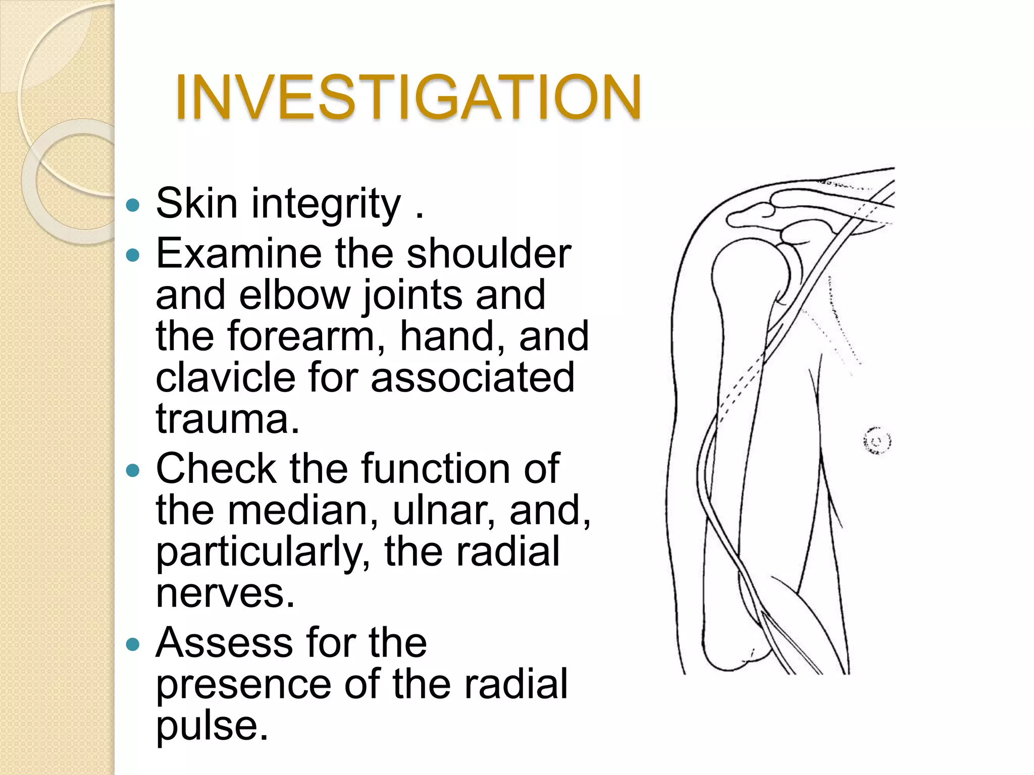 Fracture of humerus | PPTX