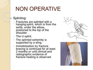 Fracture of humerus | PPTX