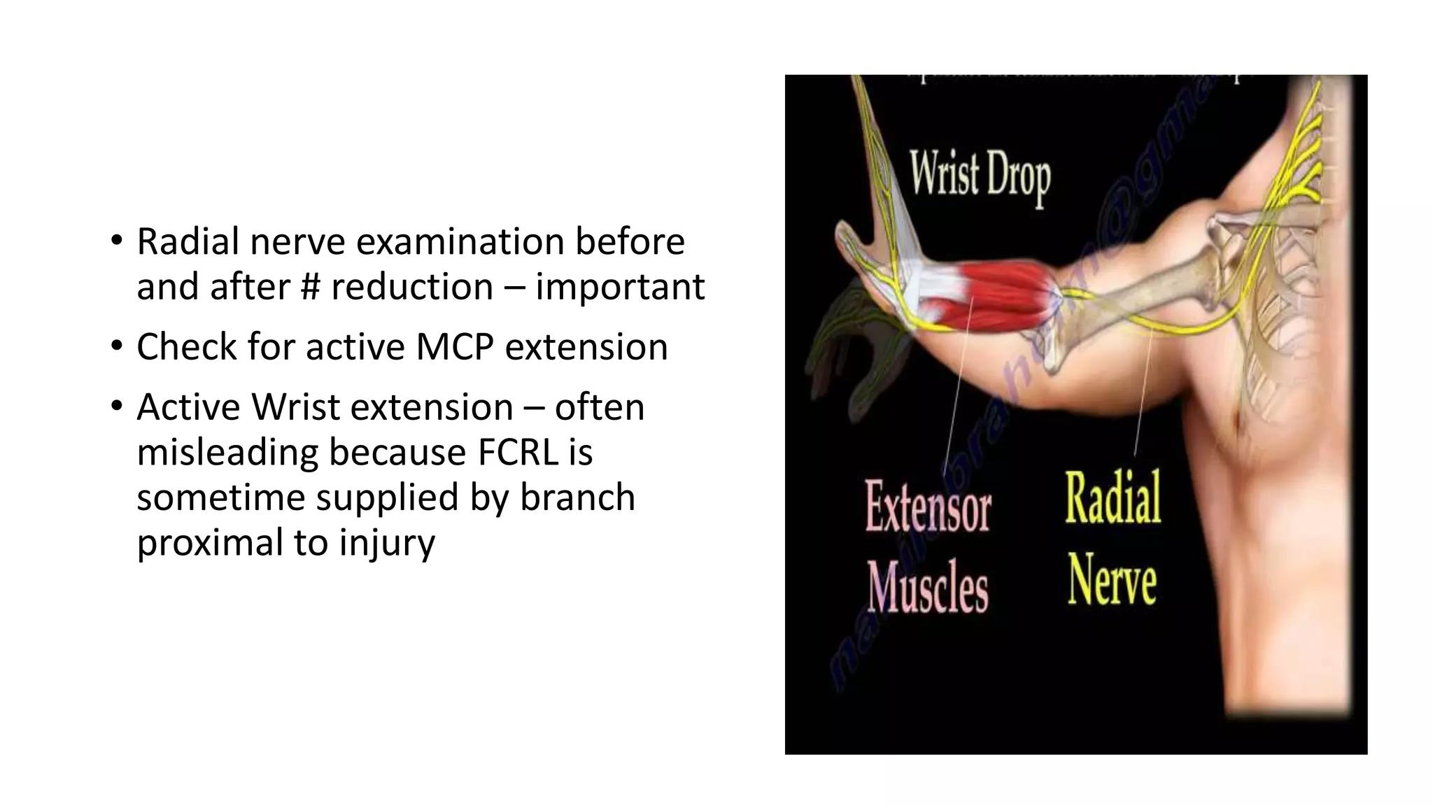 FRACTURE OF HUMERUS SHAFT AND INTERCONDYLAR FRACTURE.pdf