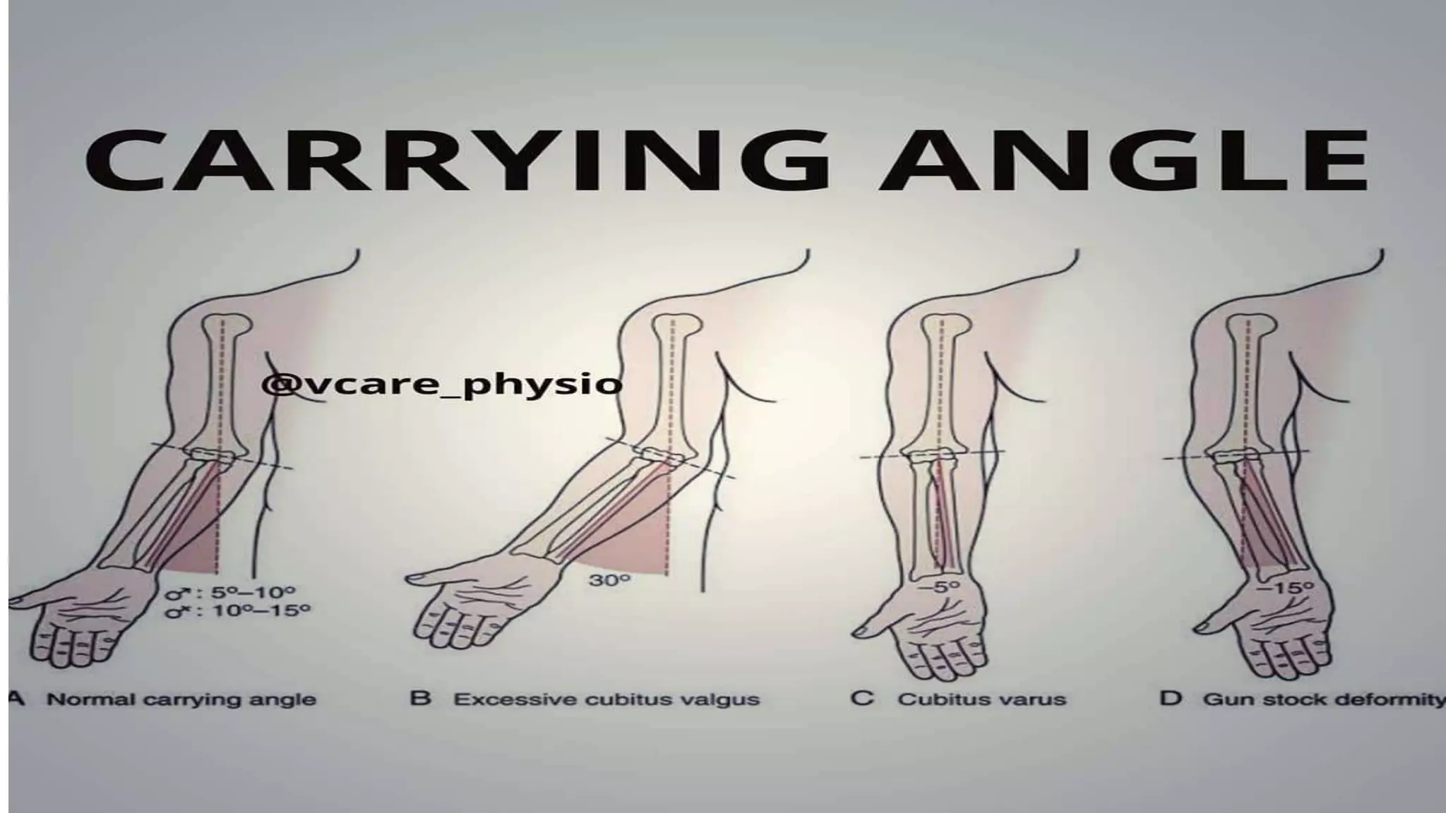 FRACTURE OF HUMERUS SHAFT AND INTERCONDYLAR FRACTURE.pdf