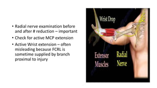 FRACTURE OF HUMERUS SHAFT AND INTERCONDYLAR FRACTURE.pdf