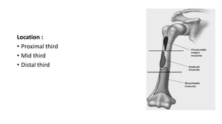 FRACTURE OF HUMERUS SHAFT AND INTERCONDYLAR FRACTURE.pdf