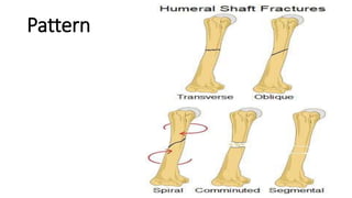 FRACTURE OF HUMERUS SHAFT AND INTERCONDYLAR FRACTURE.pdf