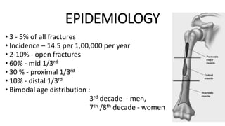 FRACTURE OF HUMERUS SHAFT AND INTERCONDYLAR FRACTURE.pdf