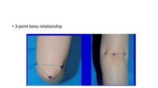 FRACTURE OF HUMERUS SHAFT AND INTERCONDYLAR FRACTURE.pdf