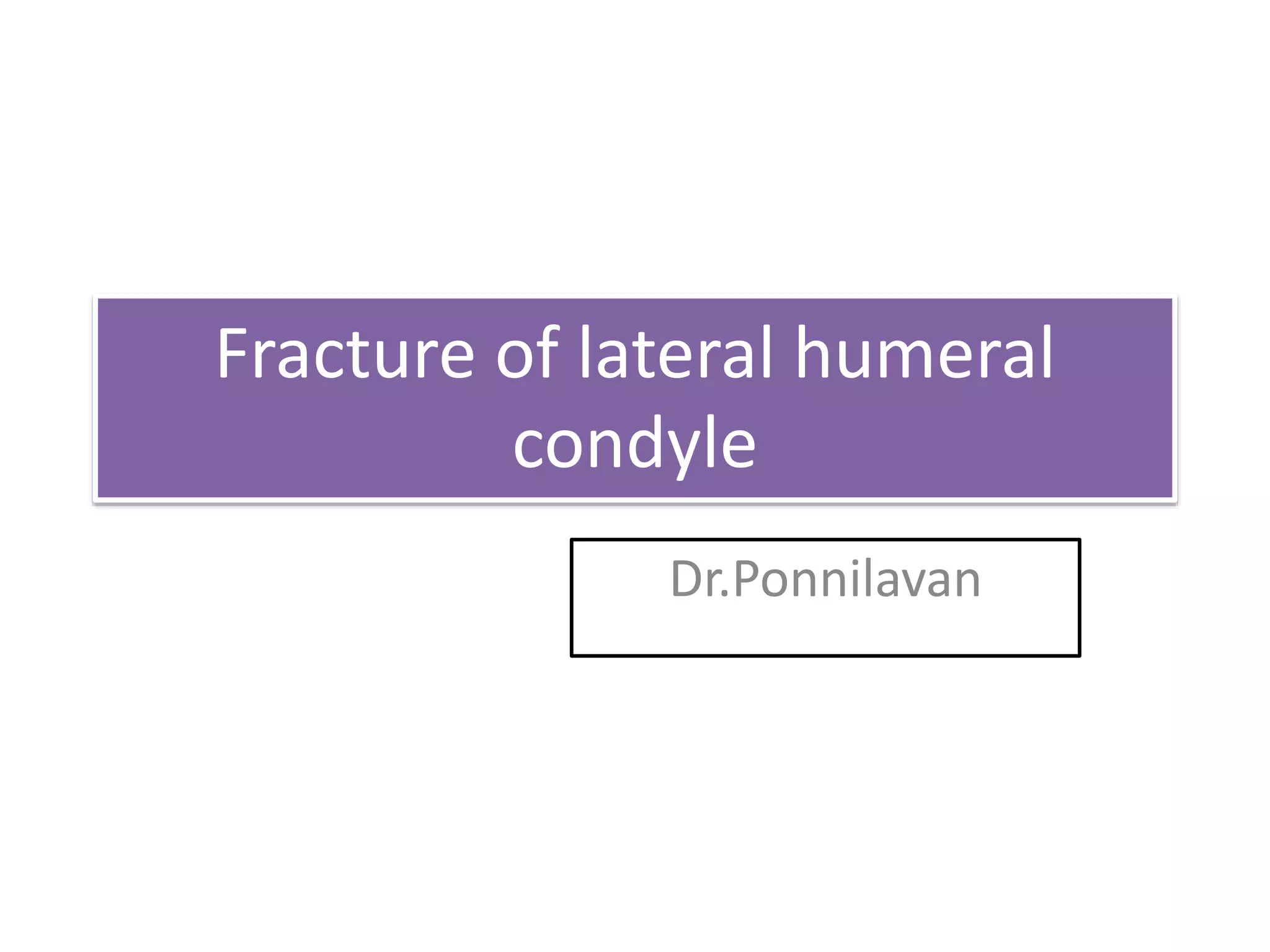 Fracture of lateral humeral condyle | PPTX