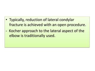 Fracture of lateral humeral condyle | PPTX