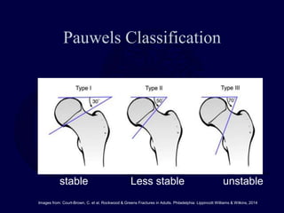 Fracture of neck of femur | PPT