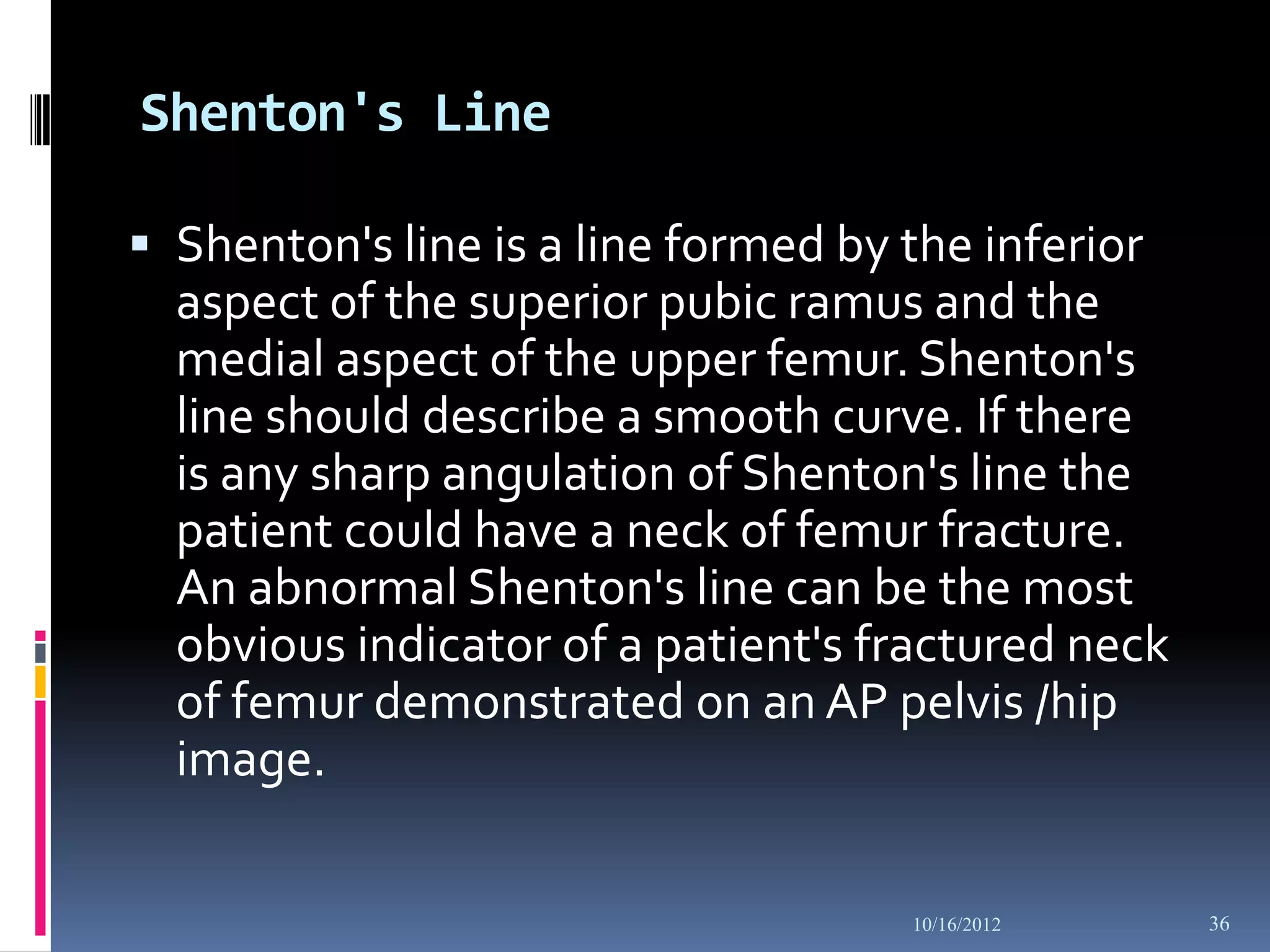 Fracture neck of femur | PPTX