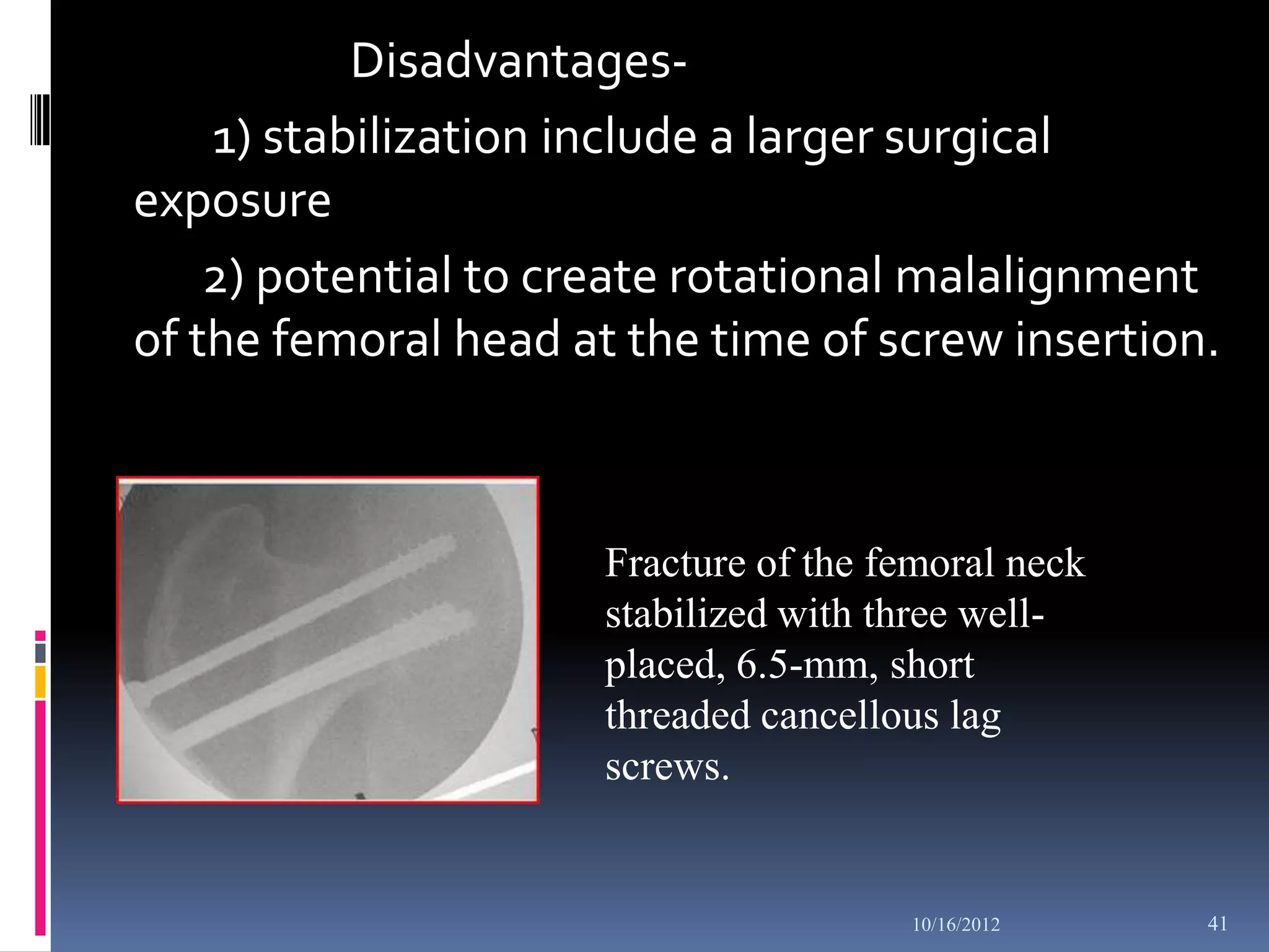 Fracture neck of femur | PPTX