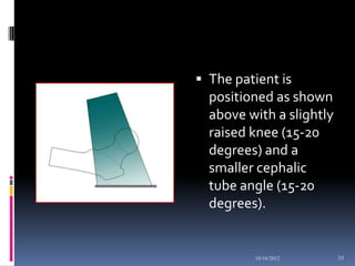 Fracture neck of femur | PPTX