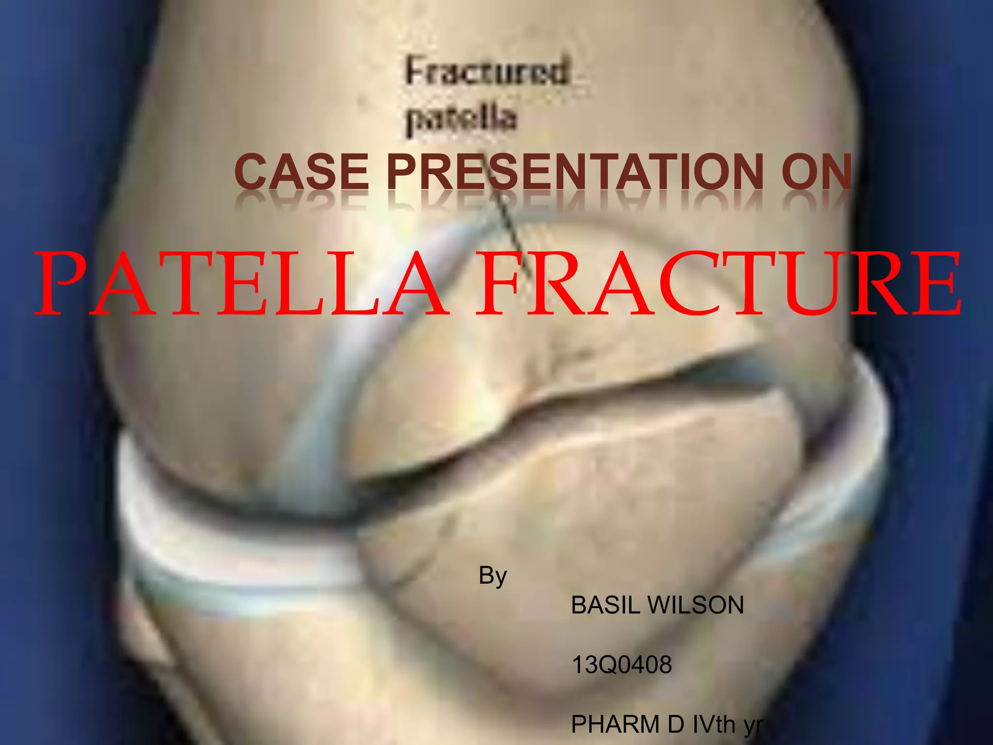 Fracture of patella | PPTX