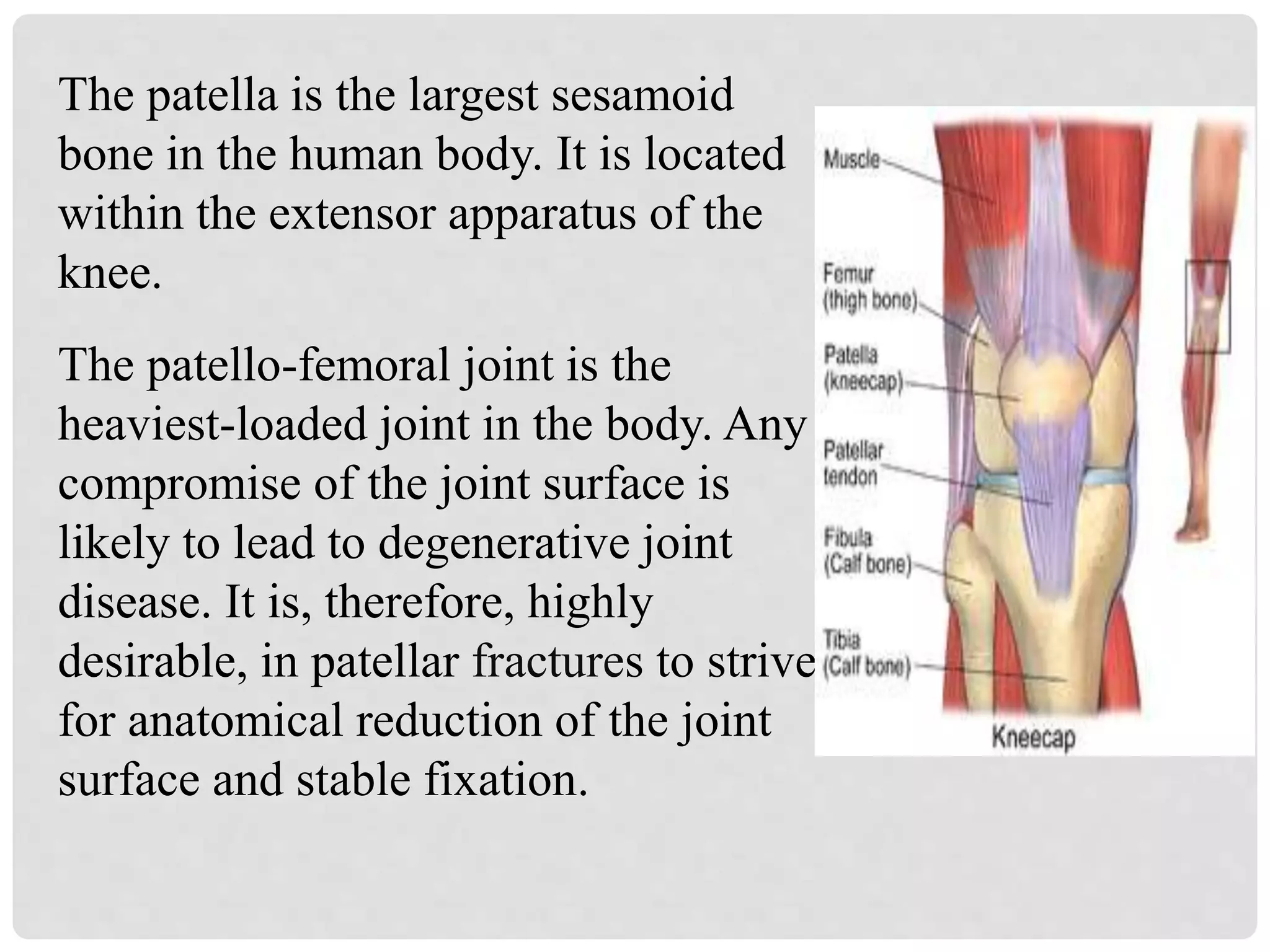 Fracture of patella | PPTX