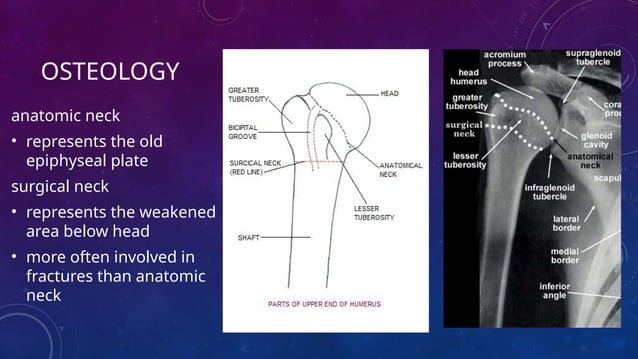 FRACTURE OF PROXIMAL HUMERUS- Etiopathogenesis , clinical features and ...