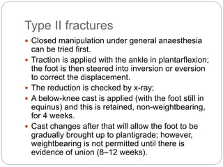 FRACTURE OF TALUS.pptx. ..... | PPTX