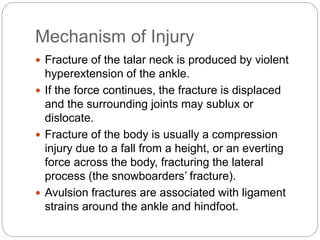 FRACTURE OF TALUS.pptx. ..... | PPT