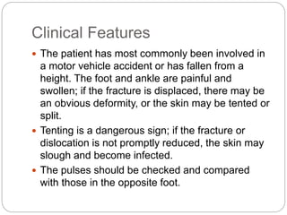 FRACTURE OF TALUS.pptx. ..... | PPT