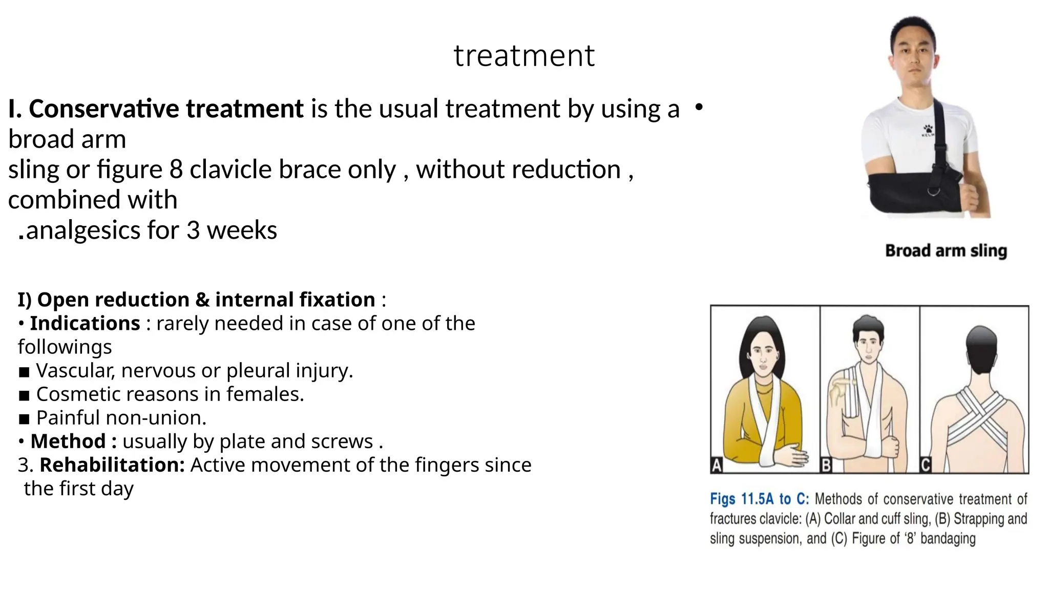 Fracture of the clavical clinical 2.pptx
