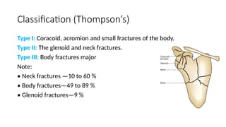 Fracture of the clavical clinical 2.pptx