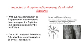 Fracture of the distal radius | PPTX