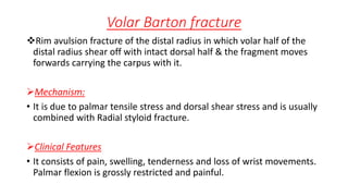 Fracture of the distal radius | PPTX