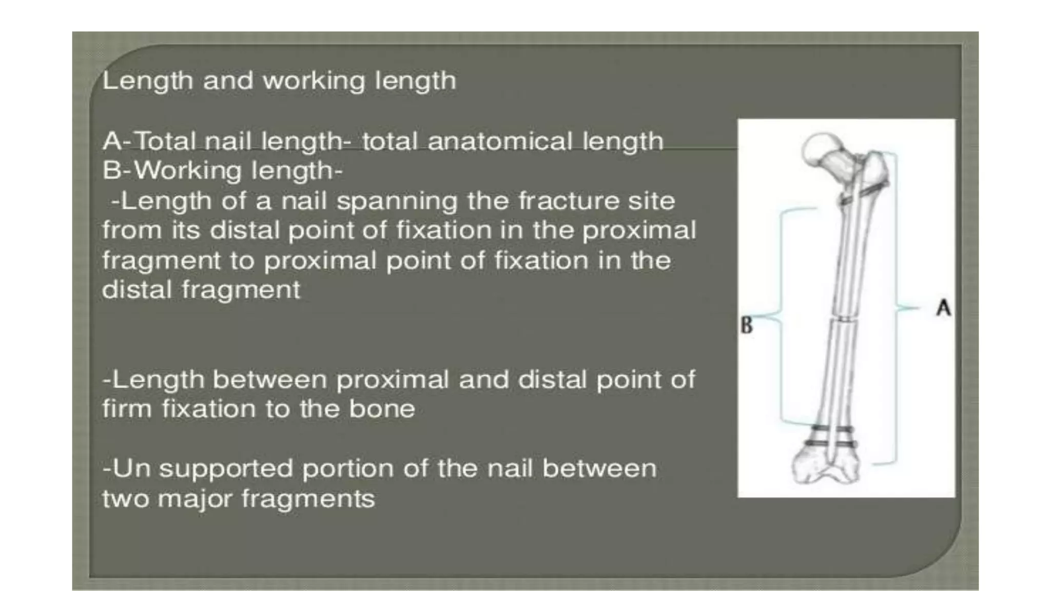 Fracture of the femoral shaft | PPT