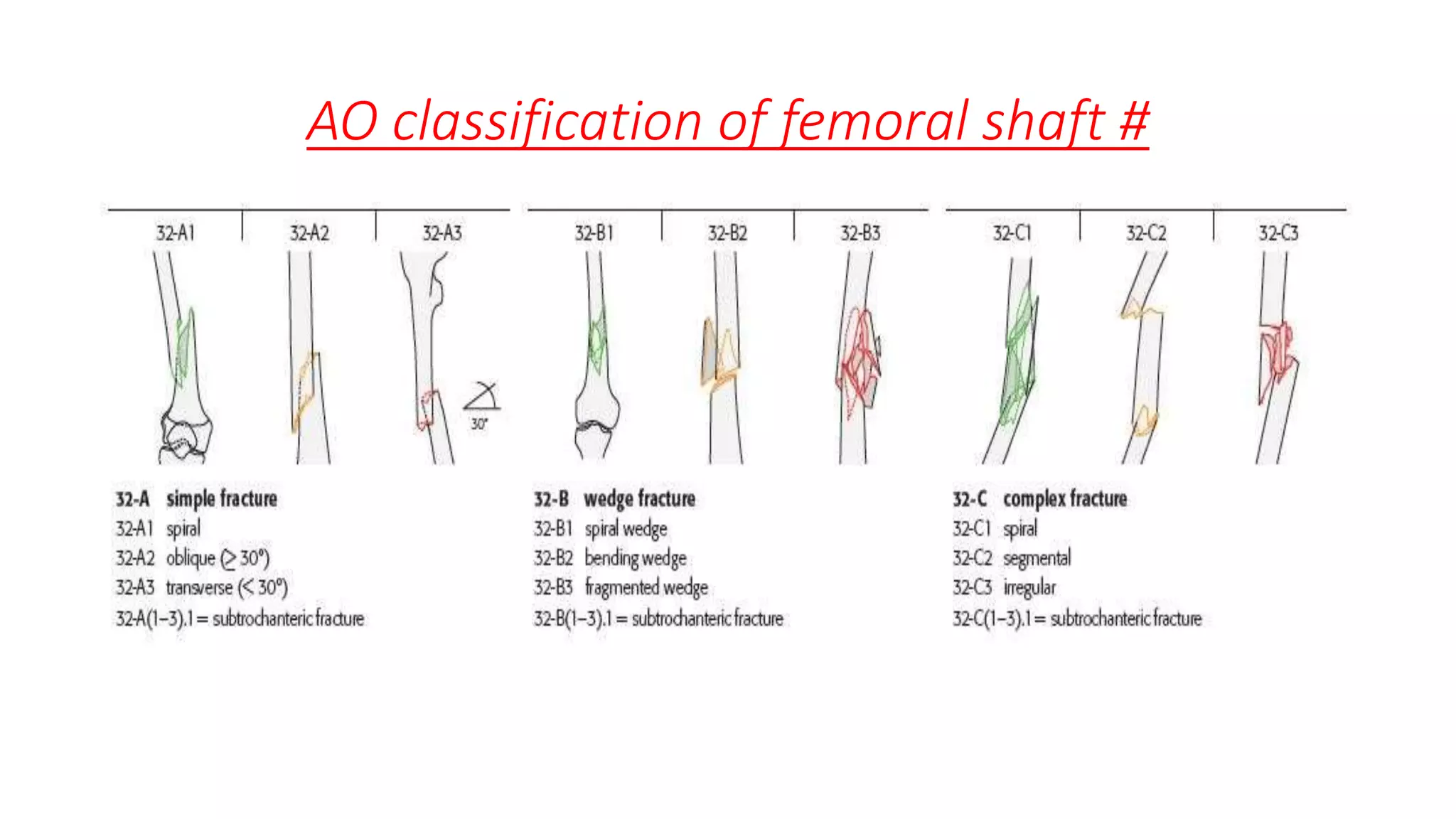 Fracture of the femoral shaft | PPT