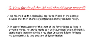 Fracture of the femoral shaft | PPT