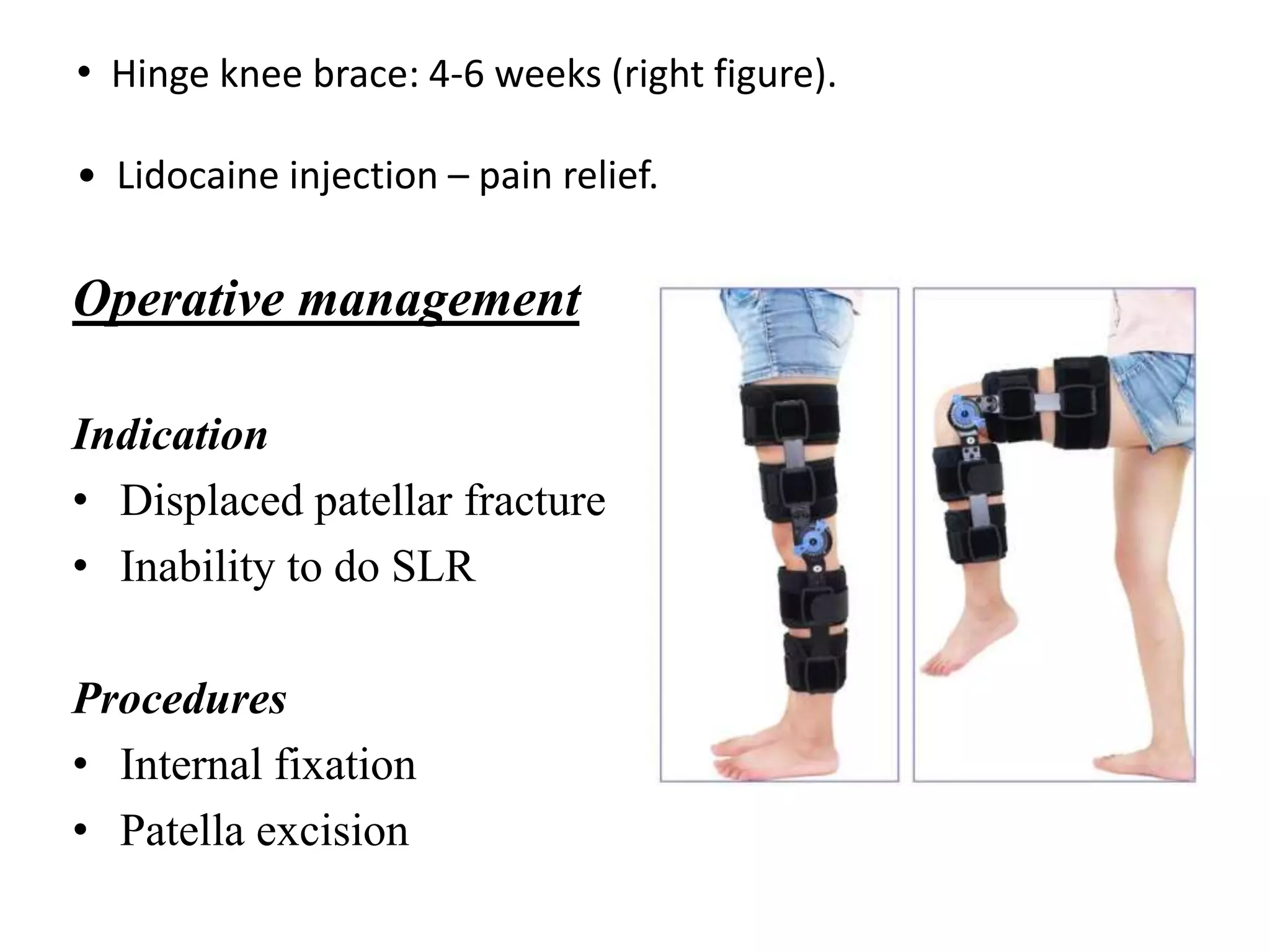 FRACTURE OF THE PATELLA.pptx