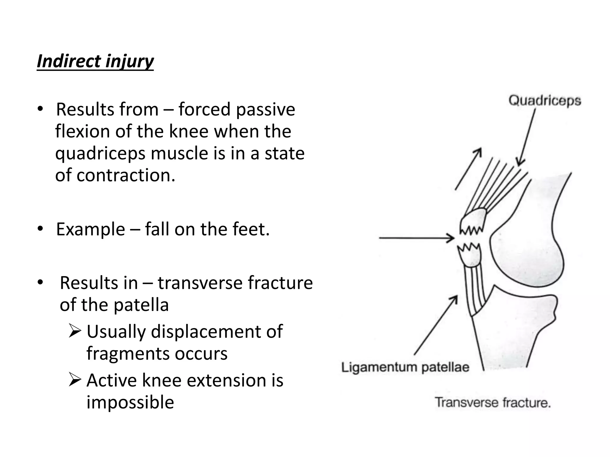 FRACTURE OF THE PATELLA.pptx