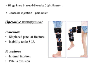 FRACTURE OF THE PATELLA.pptx