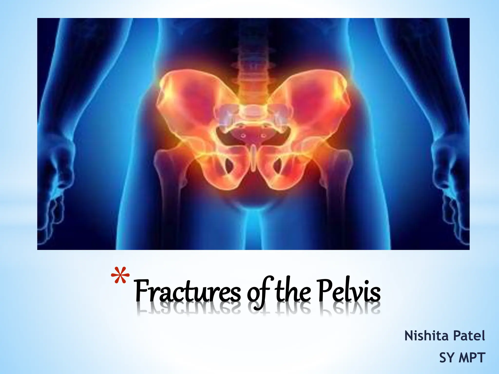 Fractures of the Pelvis bone and its physiotherapy rehabilitation .pptx