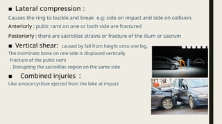 fracture of the pelvis Clinical assessmenta.pptx