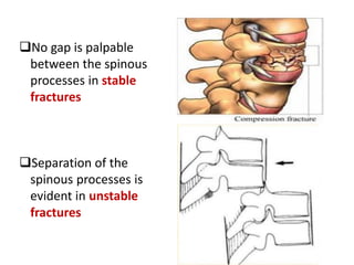 Fracture of the Spine as one of the major orthopedic trauma .pdf