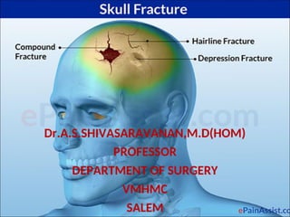 FRACTURE OF THE VAULT OF THE SKULL .ppt