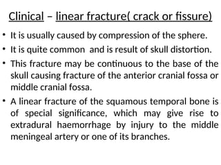 FRACTURE OF THE VAULT OF THE SKULL .ppt