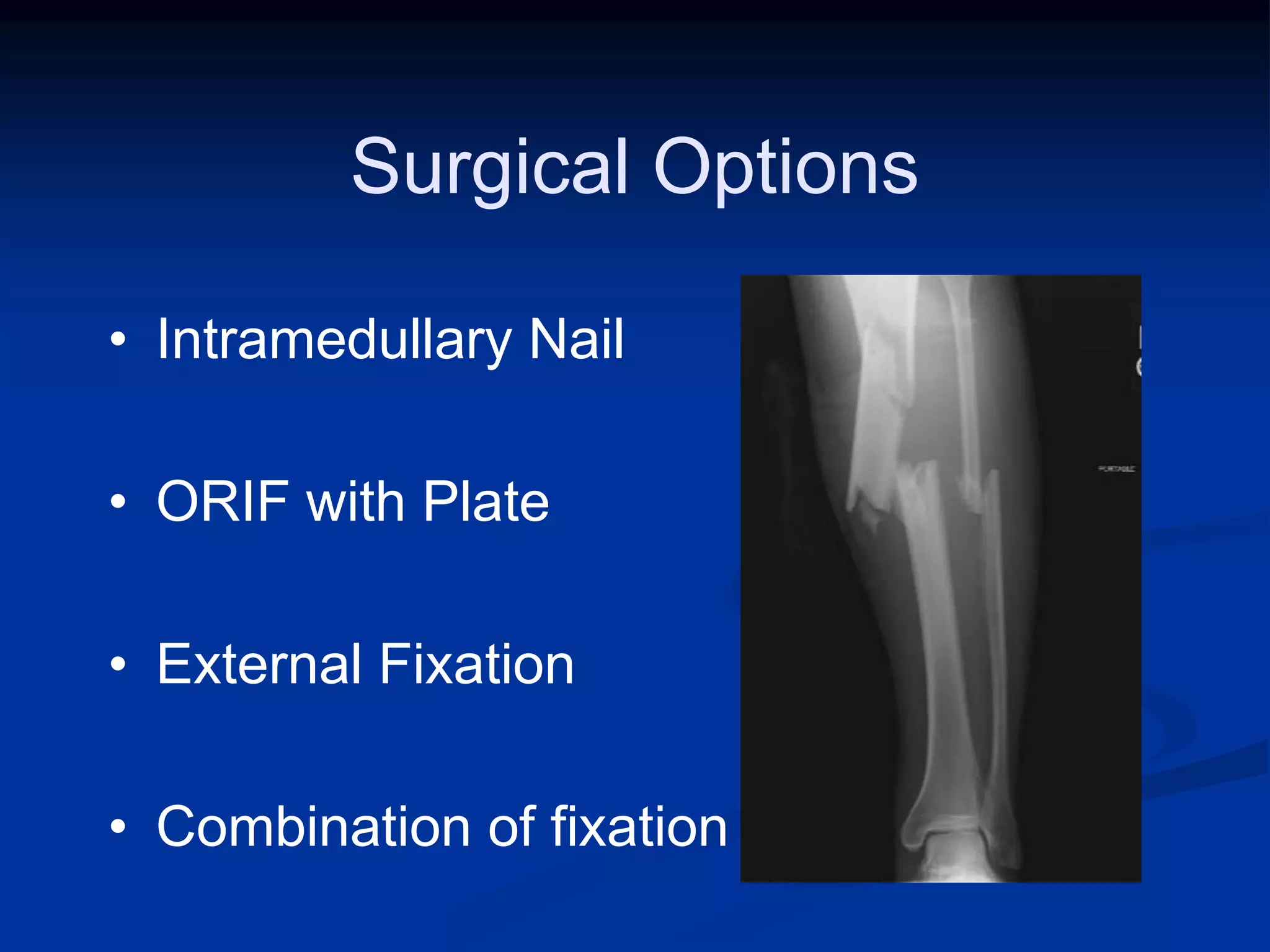 Fracture of Tibia,ankle and foot.ppt