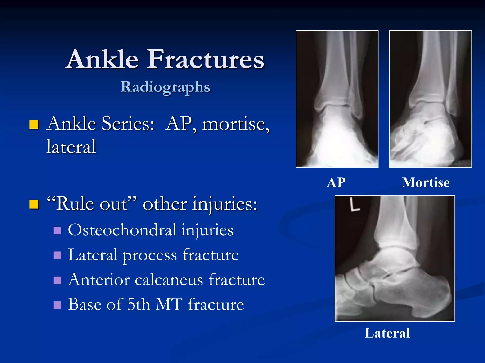 Fracture of Tibia,ankle and foot.ppt