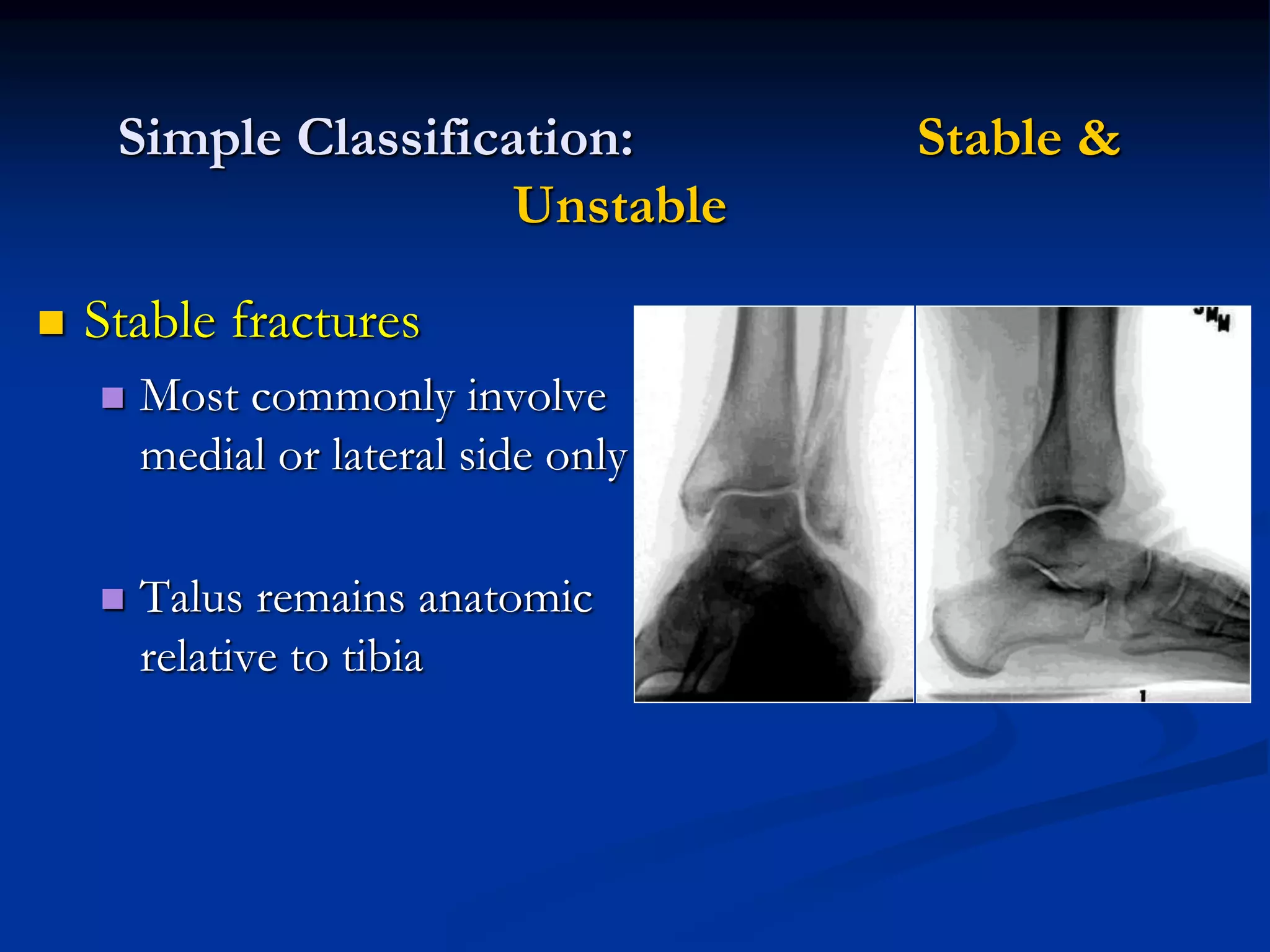 Fracture of Tibia,ankle and foot.ppt