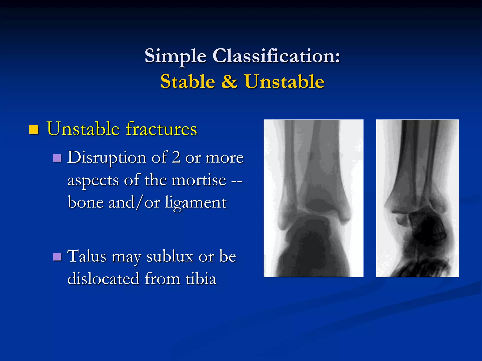 Fracture of Tibia,ankle and foot.ppt