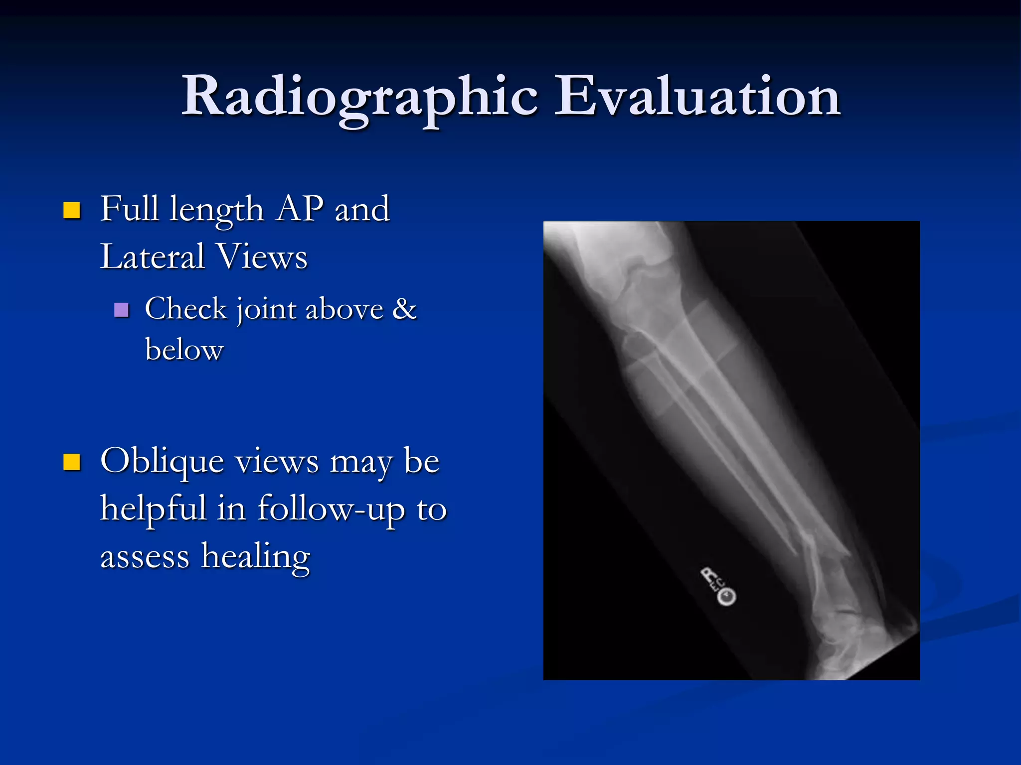 Fracture of Tibia,ankle and foot.ppt